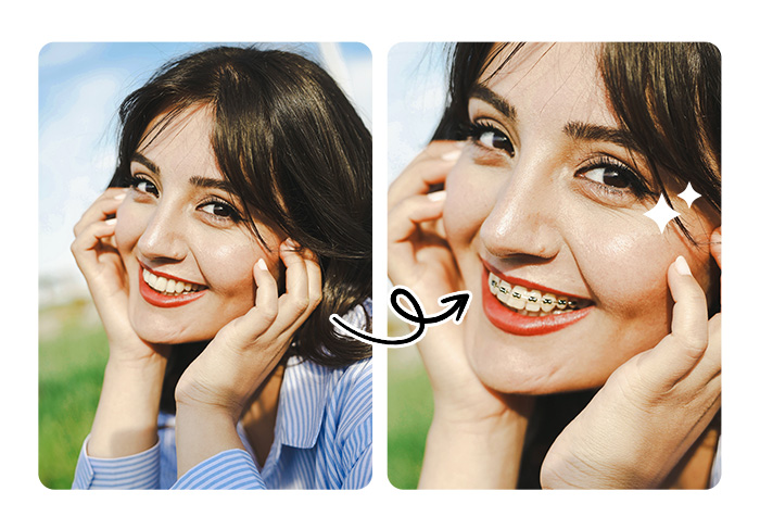 Braces Filter: Know How You Look with Braces [App & Online]