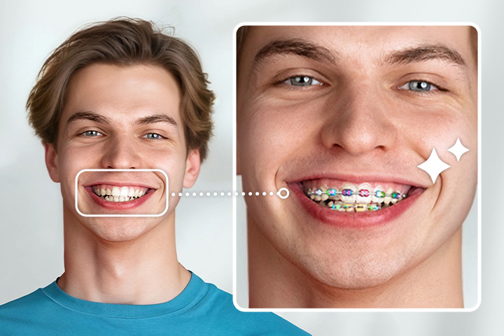 Braces Filter: Know How You Look with Braces [App & Online]